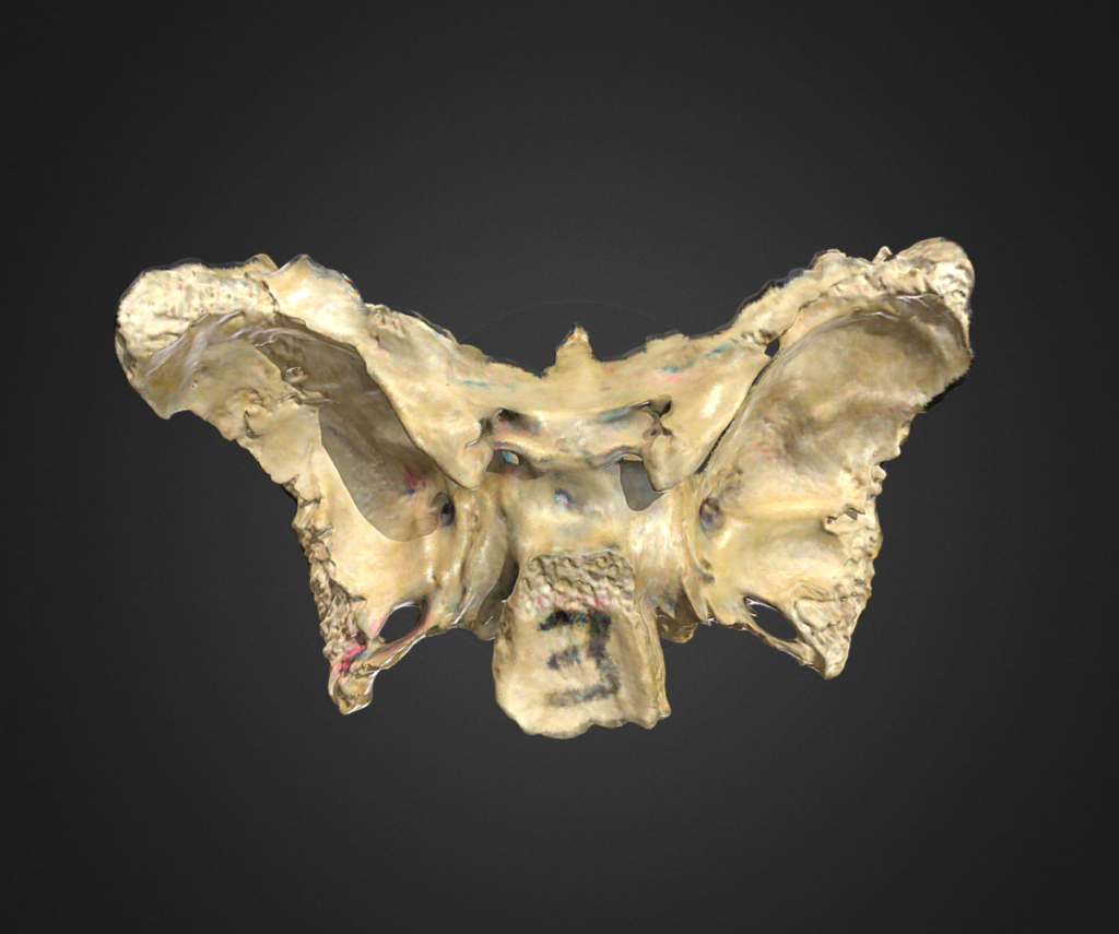 Base del Cráneo - Anatomía Humana 3D - UACH