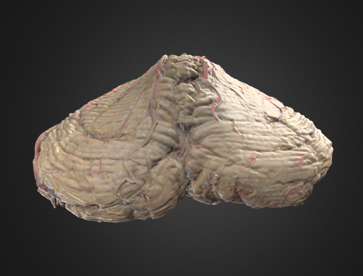 Laringe y Tráquea - Anatomía Humana 3D - UACH