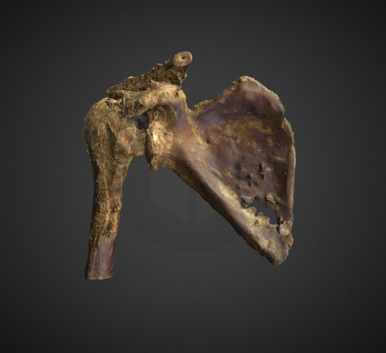 Clavícula - Anatomía Humana 3D - UACH